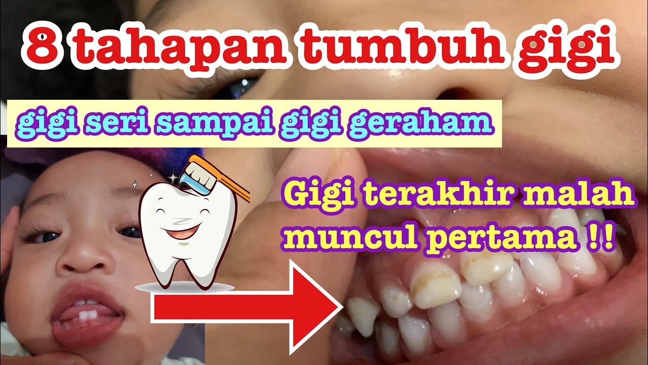 URUTAN TUMBUH GIGI SUSU BALITA DARI GIGI SERI SAMPAI GIGI GERAHAM ...
