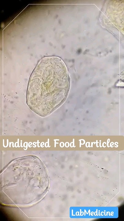 Undigested Food Particles || Stool Microscopy - YouTube