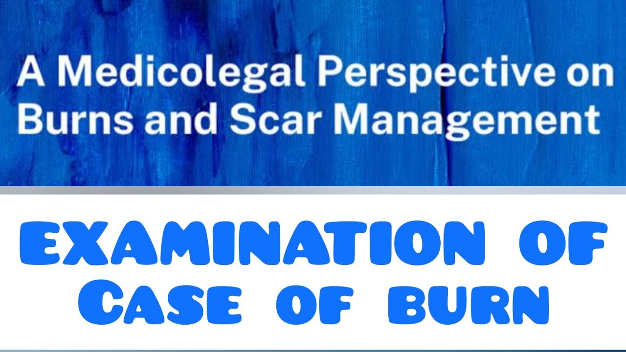 EXAMINATION OF CASE OF BURN| MLC | FORENSIC MEDICINE - YouTube