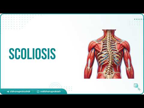 Scoliosis: Types, Pathology, Clinical features, Diagnosis, Treatment