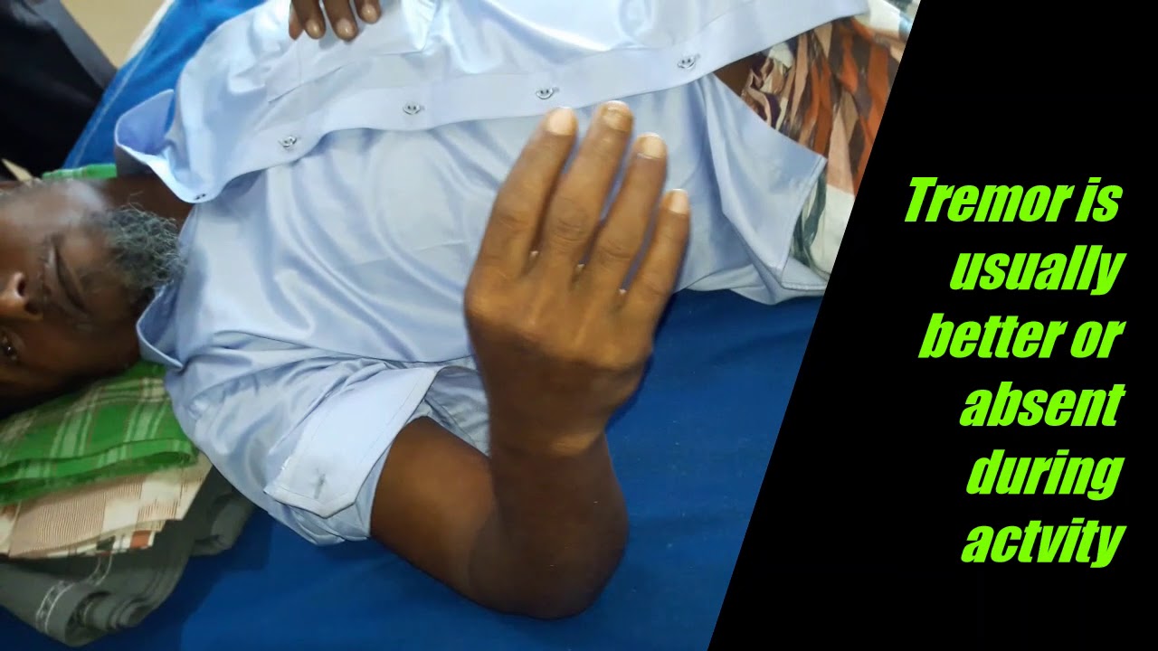 Tremor in Parkinson's Disease || Resting tremor - YouTube