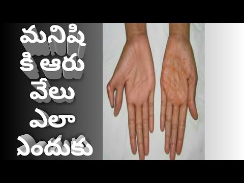 How humans have six fingers? How it is possible? - YouTube