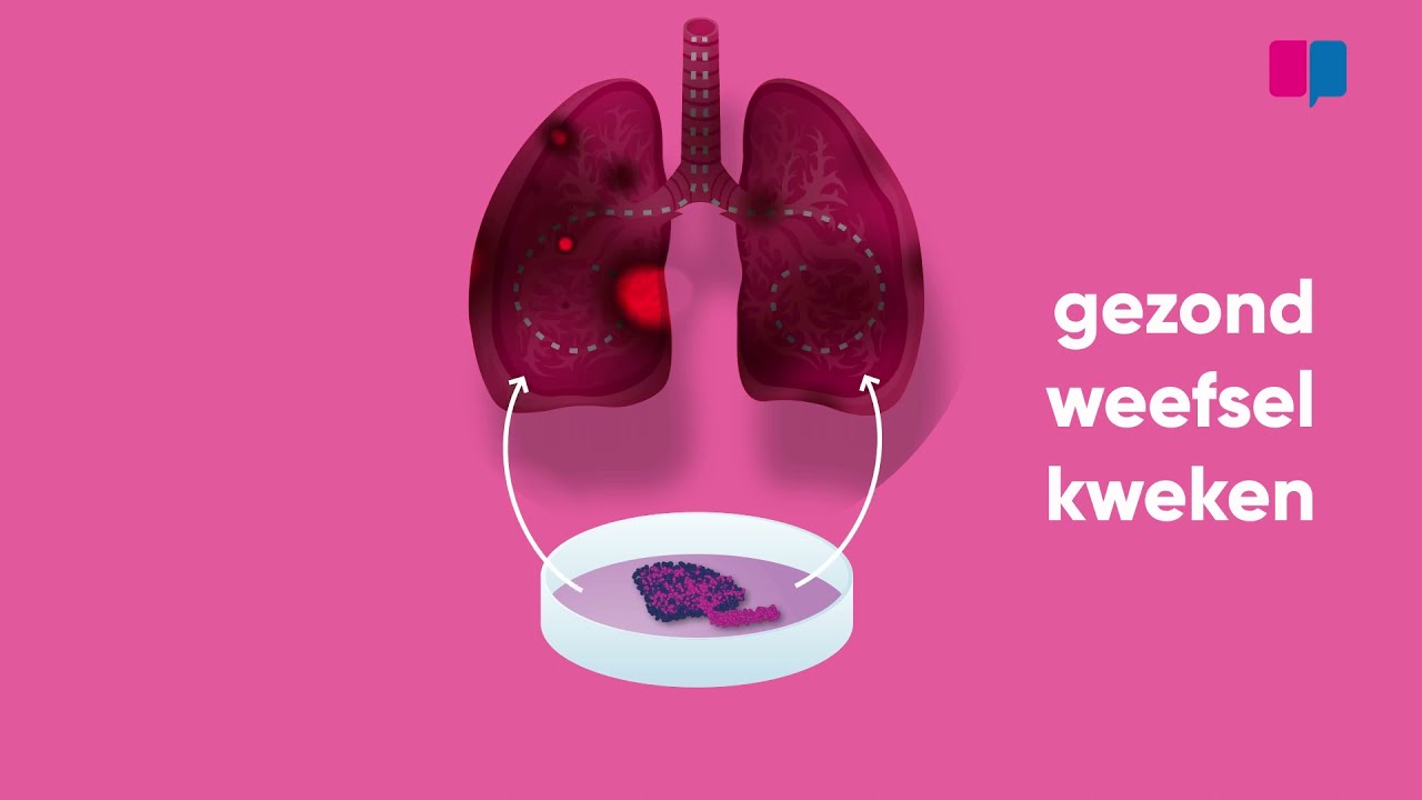 Beschadigde longen repareren met de mini-long - YouTube