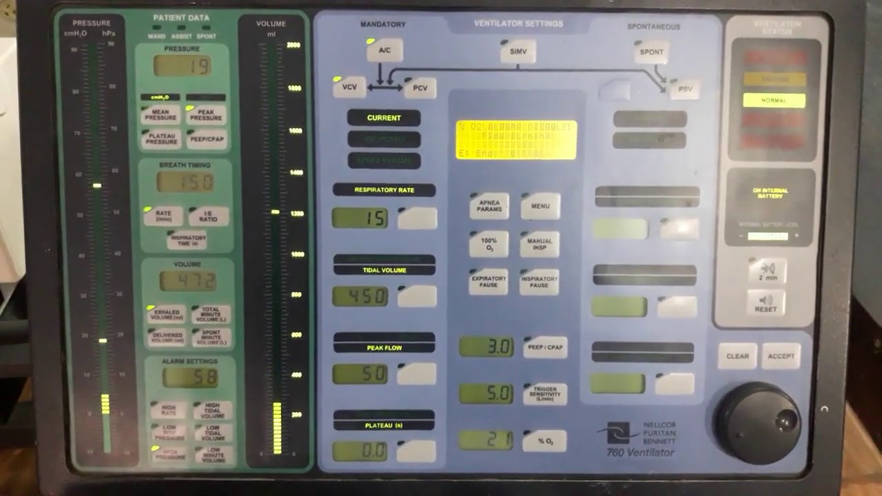 PB 760 ventilator working process - YouTube