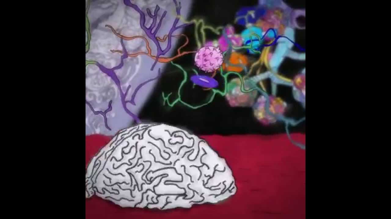 Brain Car - Dream Car of the Day - YouTube