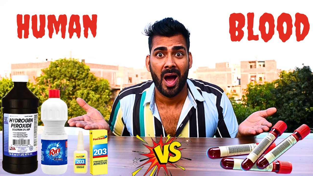 Experiment With Real Blood🩸😱 | Blood Vs Bleach, Fevikwik and Hydrogen ...