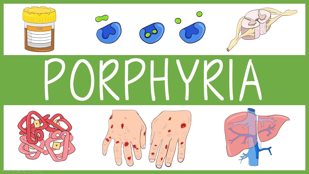 Porphyria Visually Explained - YouTube