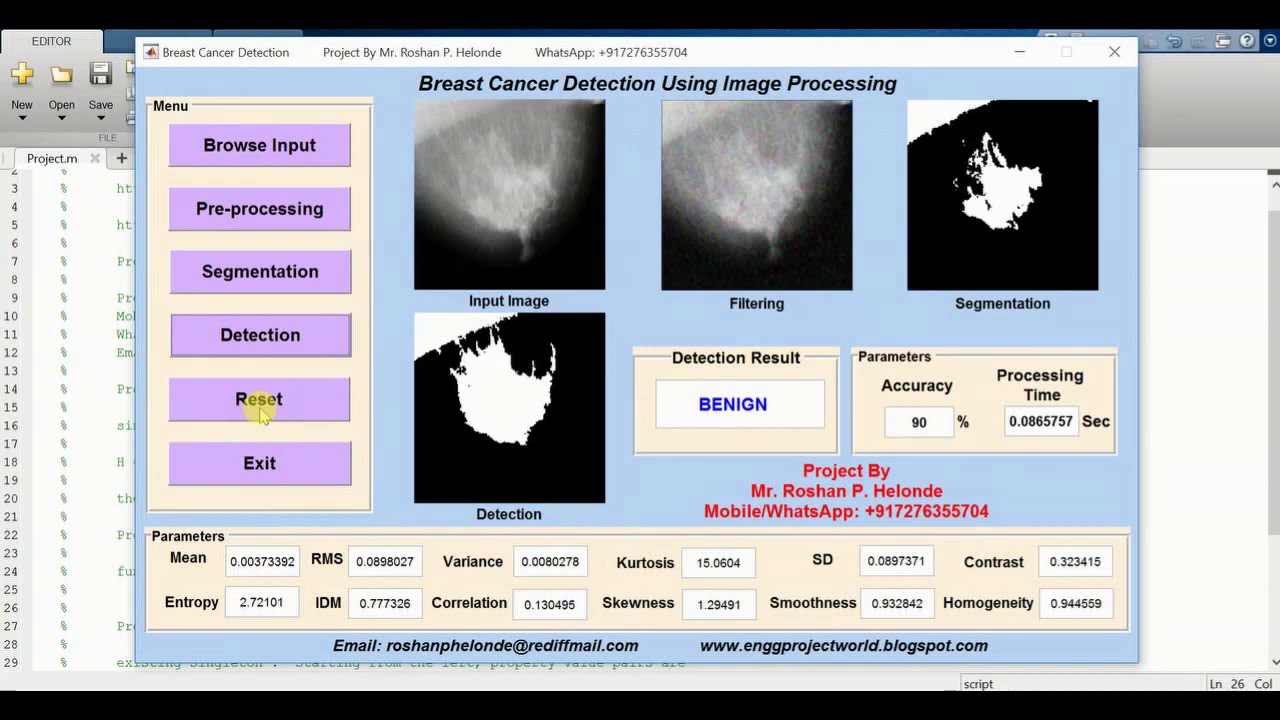 Breast Cancer Detection Using Machine Learning Matlab Source Code