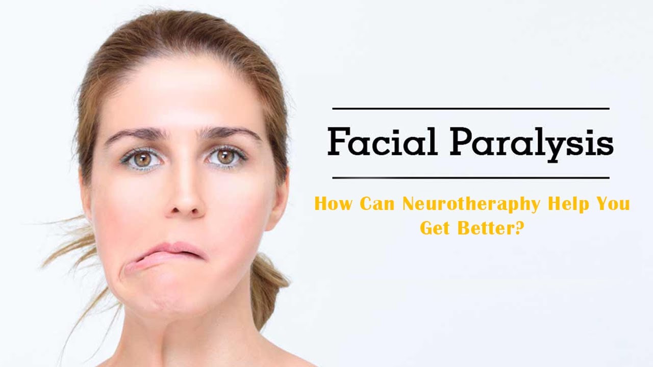 bell’s palsy,pathophysiology , symptoms,facial paralysis,muh ka lakwa ...