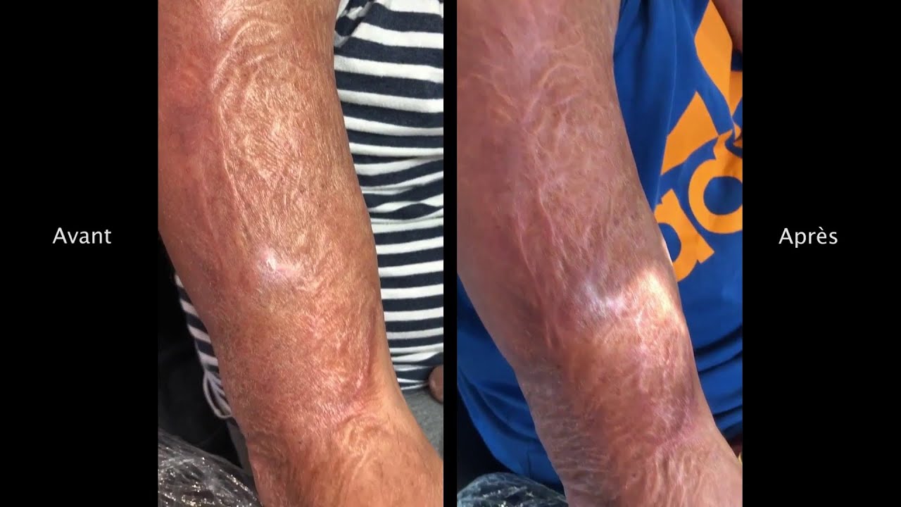 J'ai été invité sur le journal de France 3 pour parler de tatouages sur ...
