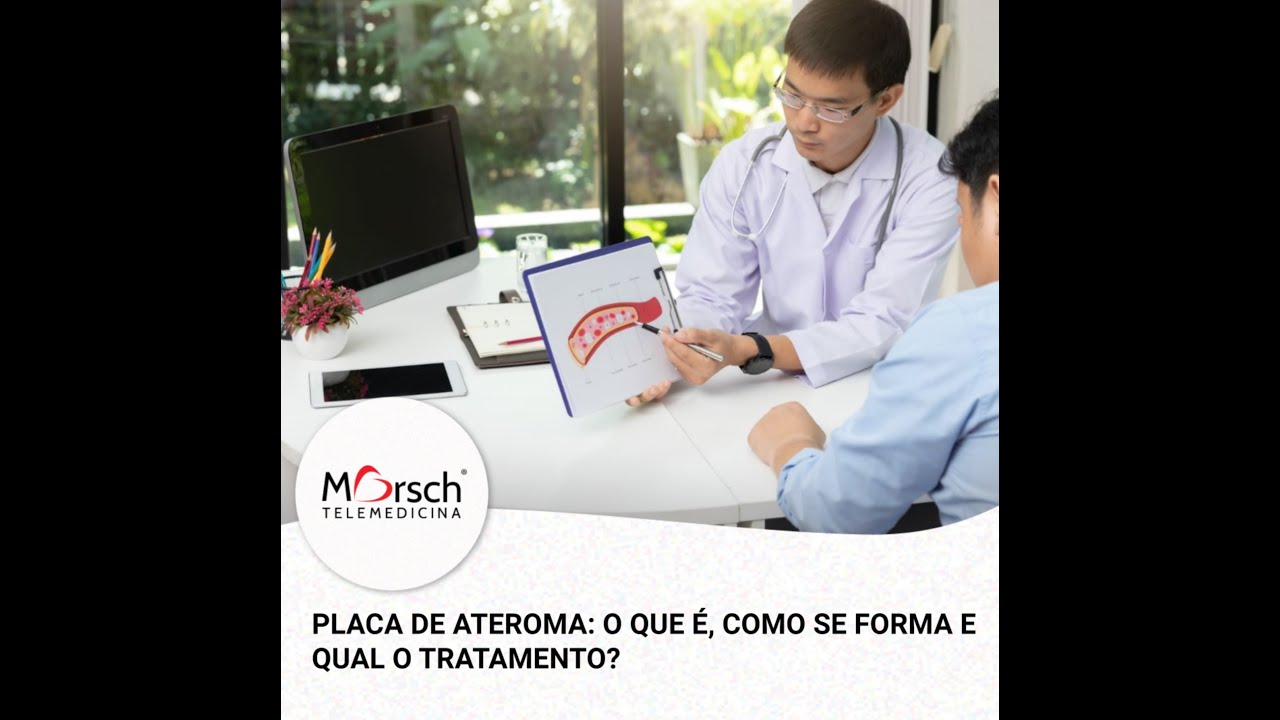 PLACA DE ATEROMA: O QUE É, COMO SE FORMA E QUAL O TRATAMENTO? - YouTube