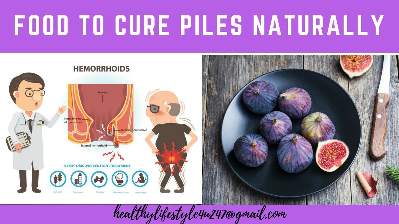 How To Cure Piles At Home Fast In Just 1 Month Youtube