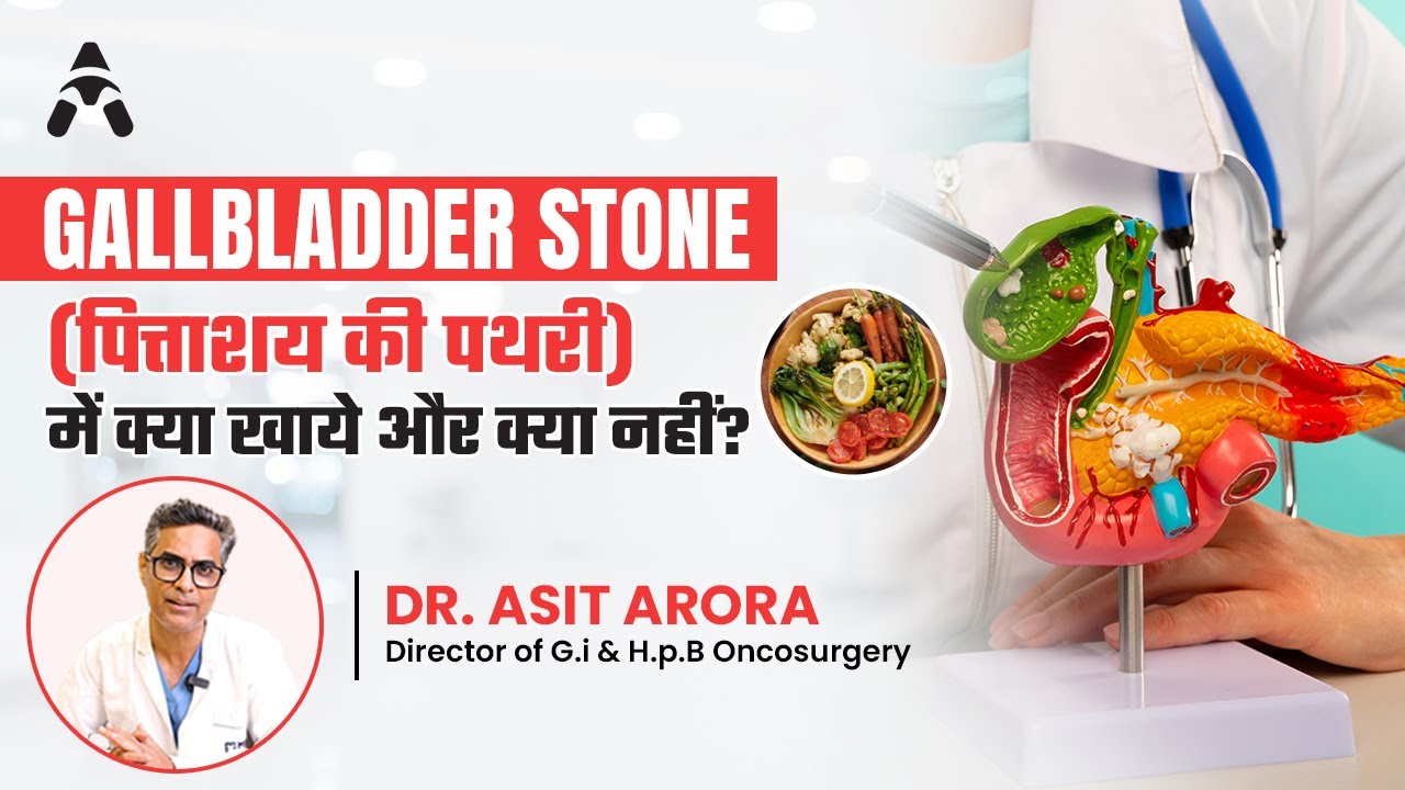 Gallbladder Stones में क्या खाएं, क्या नहीं? | Gallstones Diet Plan ...