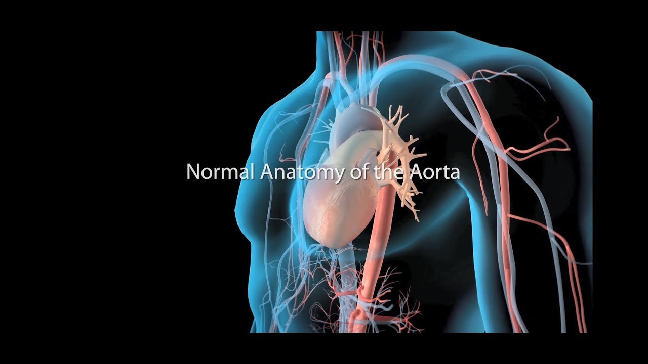 Aortic Aneurysm And Aortic Dissection YouTube