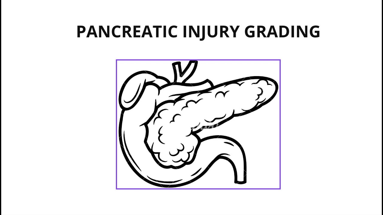 Pancreatic injury grading - Easy to remember - YouTube