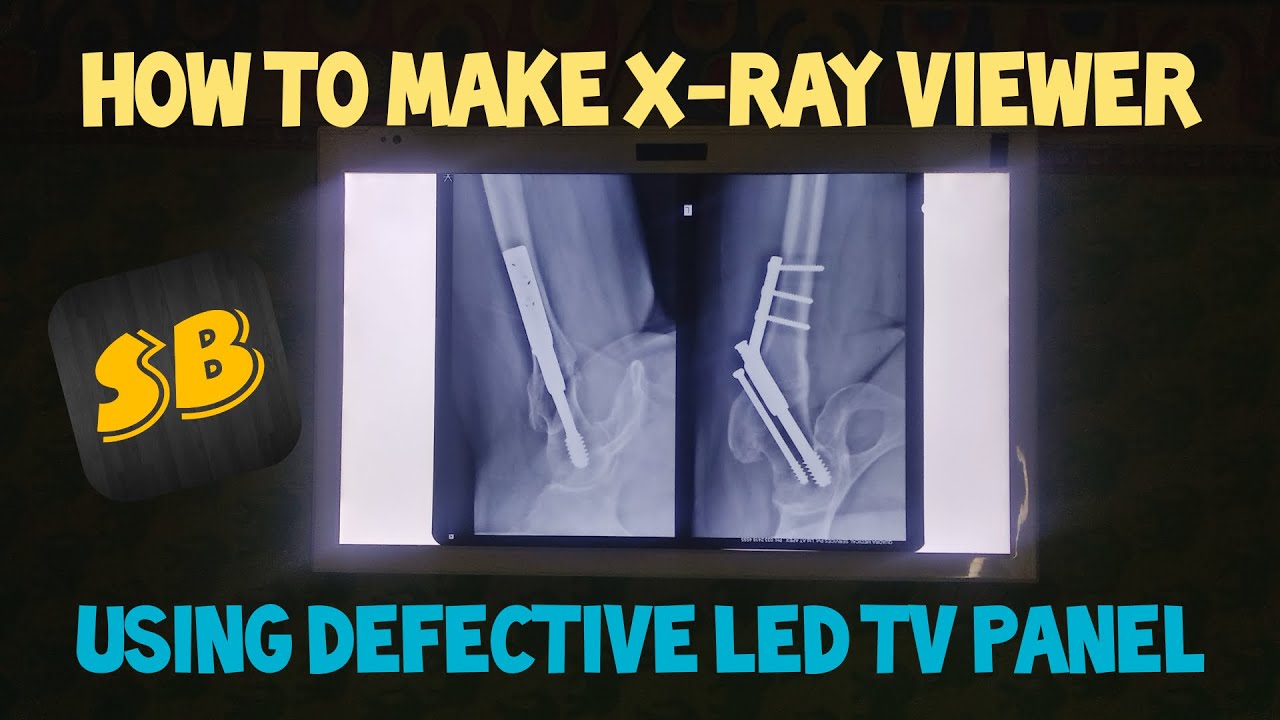How To Make X-ray Plate Viewer Using Defective LED TV Panel. - YouTube
