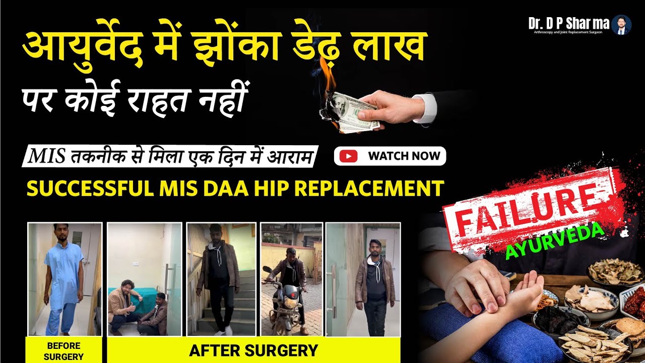 Magical Result Of MIS Hip Replacement By DAA With Bikini Incision ...