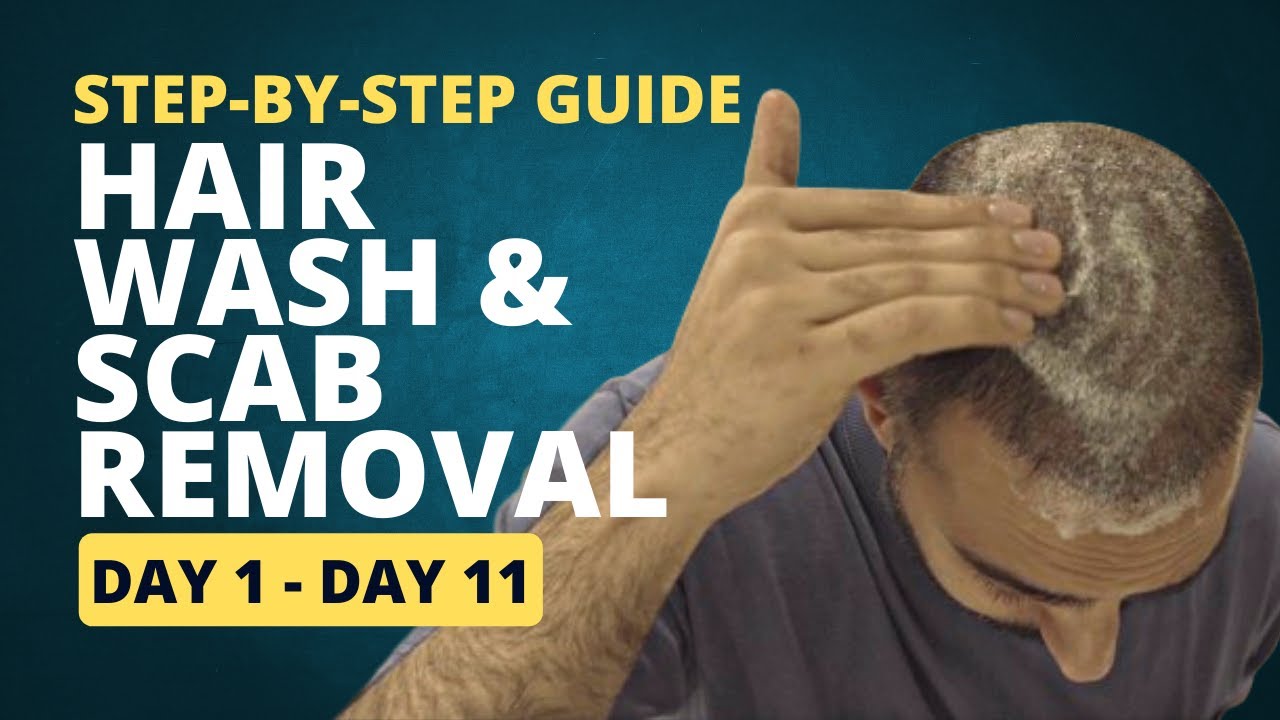 Step by Step Guide How To Wash Your Hair And Remove Scabs After A Hair step-by-step-guide-how-to-wash-your-hair-and-remove-scabs-after-a-hair