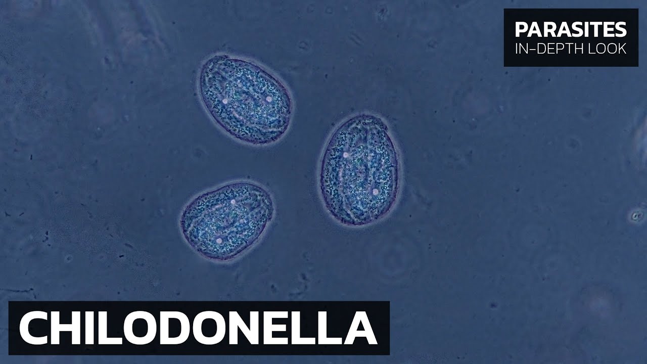 Recognizing & Treating Chilodonella sp. in Fish - YouTube