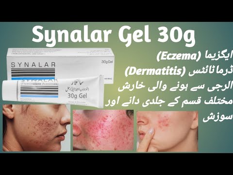Synalar 30g Gel/Cream - YouTube