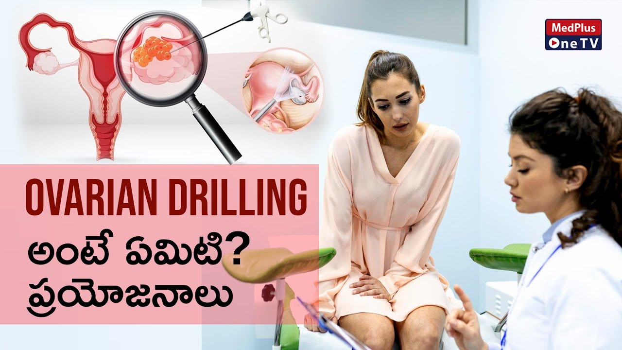 Does Ovarian Drilling Work for PCOS? l Dr. Swathi HV @MedPlusONETV ...