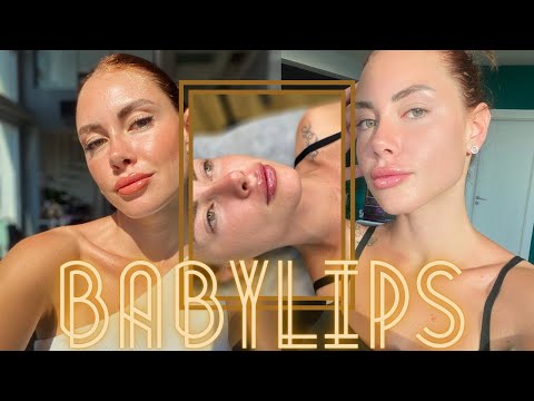 2. Babylips  Dudak Vitamin Dolgusu | 3 kişi Yaptırdık | Tüm Süreç