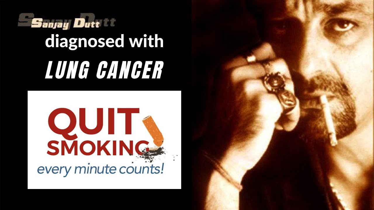 Sanjay Dutt Diagnosed With Lung Cancer | Stage 3 Lung Cancer Life ...