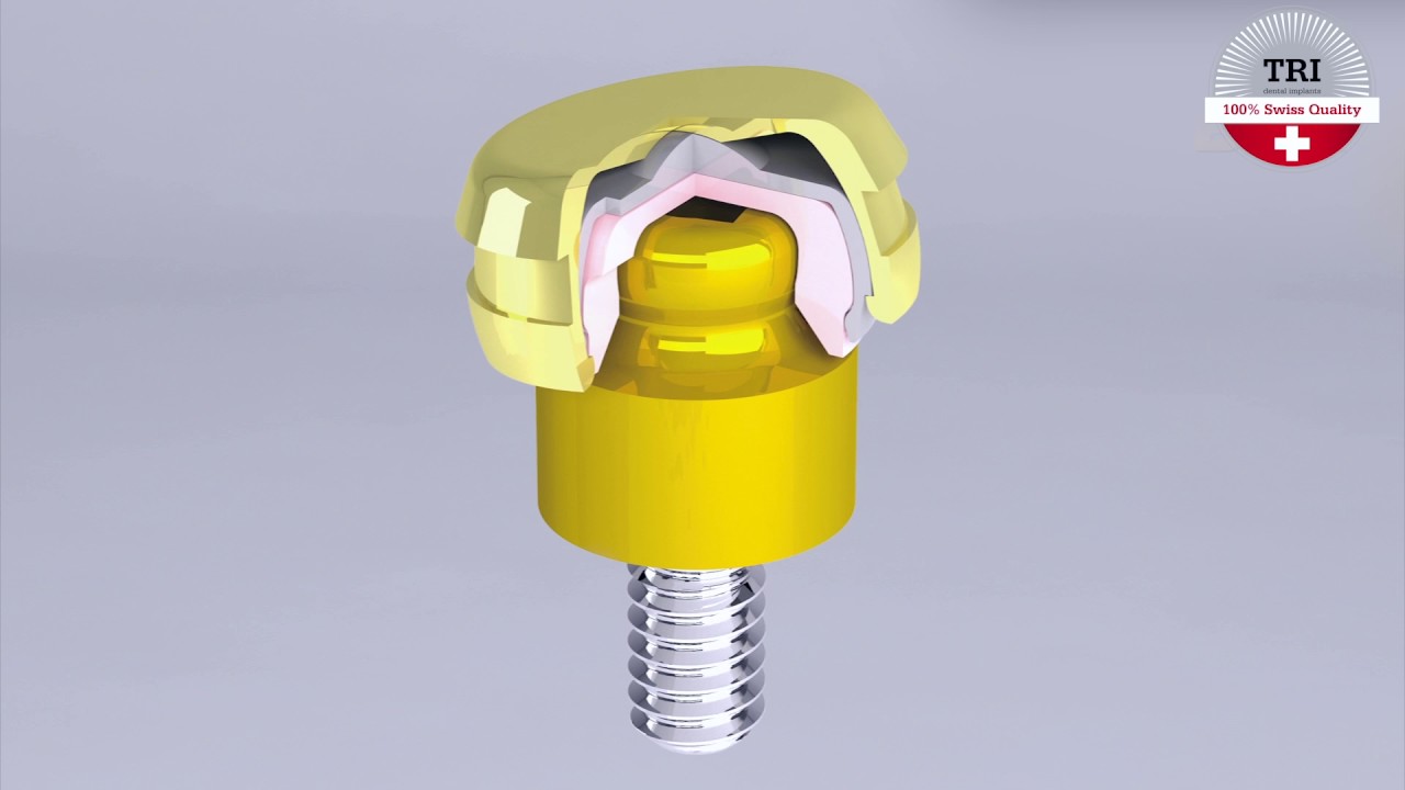 TRI® Raptor Overdenture Attachment System - YouTube