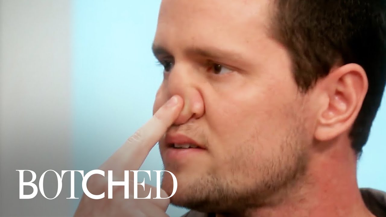 5 ALARMING Botched Nose Jobs | E! - YouTube