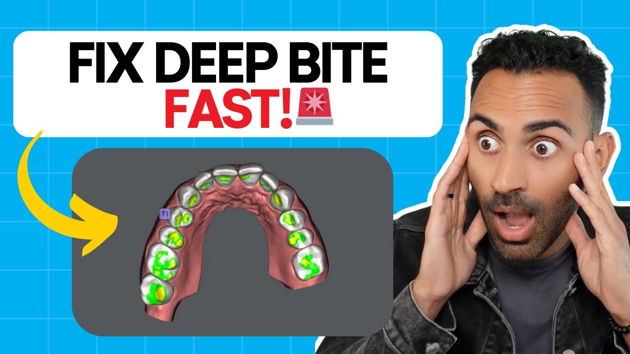 Deep Bite Cases: The BEST Attachments for Predictable Results - YouTube