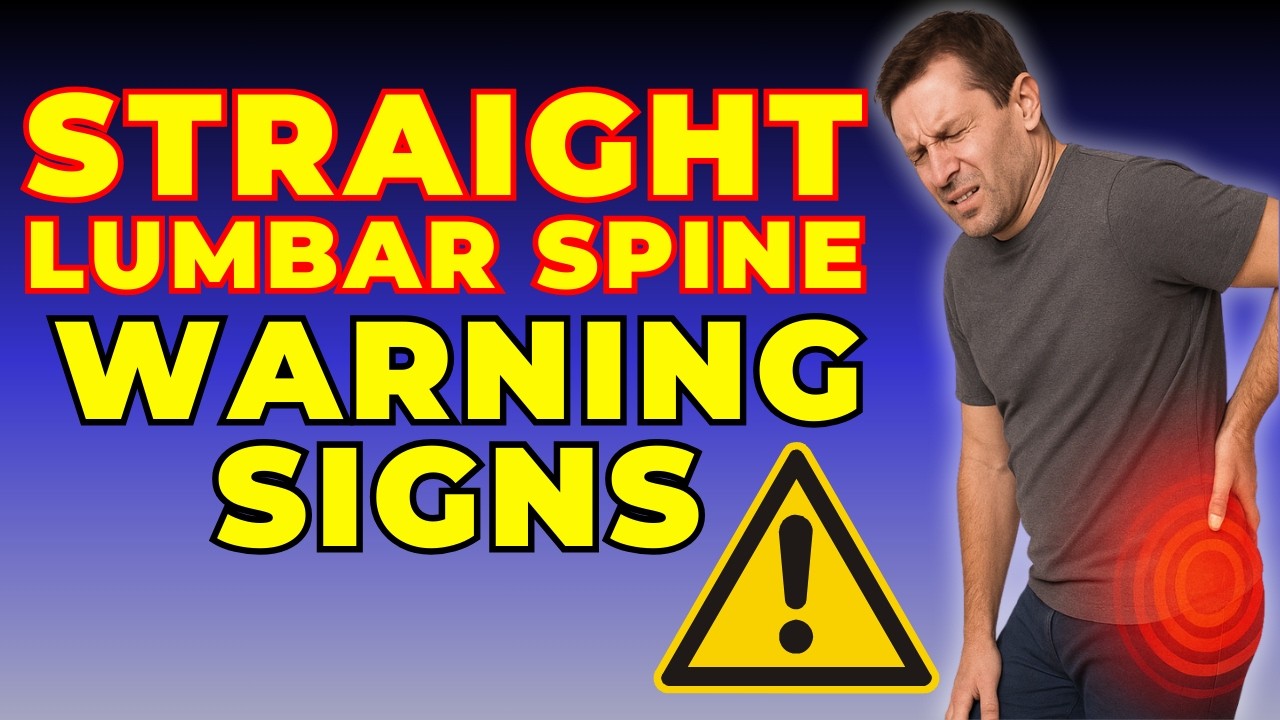 Flat Back Syndrome 5 WARNING Signs You Shouldn’t Ignore | Dr. Gregory ...