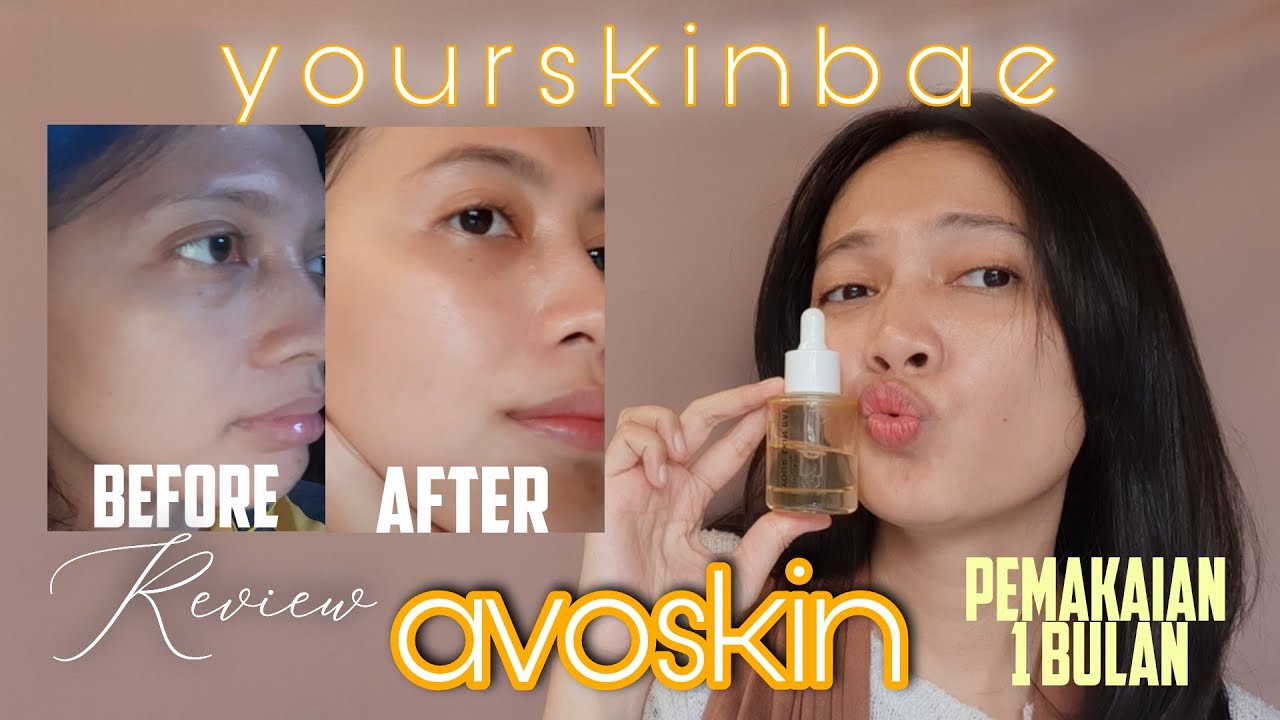 Kulit gak kusam lagi ! REVIEW AVOSKIN YOUR SKIN BAE Niacinamide 12% ...