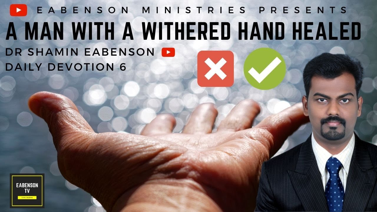 A MAN WITH A WITHERED HAND HEALED-DR SHAMIN EABENSON-EABENSON ...