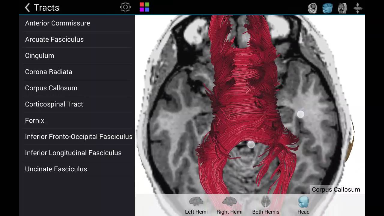 Brain Tutor Demo - YouTube