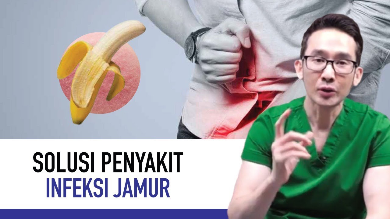 Infeksi Jamur: Penyebab, Gejala dan Cara Mengatasi | Kata Dokter - YouTube