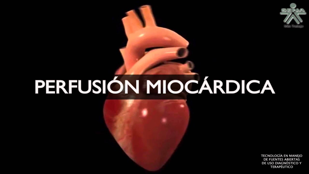Perfusión Miocárdica parte 1 Introducción de la presentación - YouTube