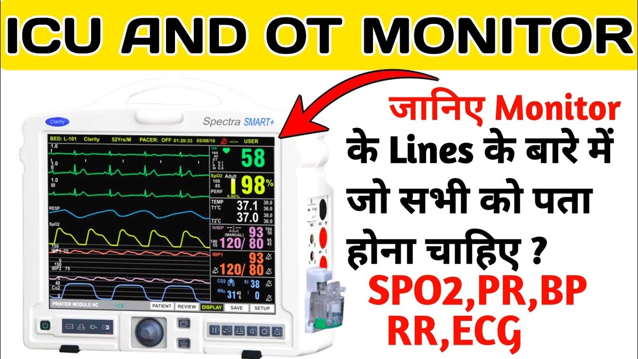 ICU Monitor Readings Explained | Ot Monitoring Machine | ICU Monitor ...