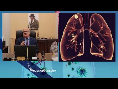 AKCİĞERDE NODÜL VE KİTLE ARASINDAKİ FARK NEDİR?