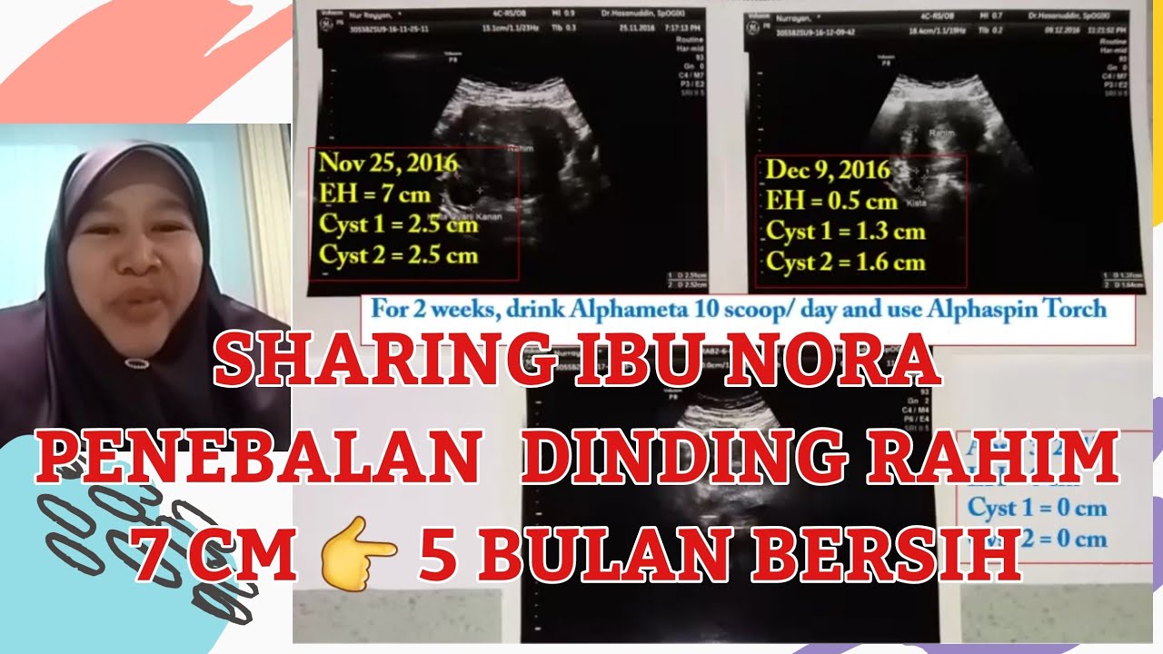PENEBALAN DINDING RAHIM/HIPERPLASIA ENDOMETRIUM BERSIH TOTAL BERKAT ...