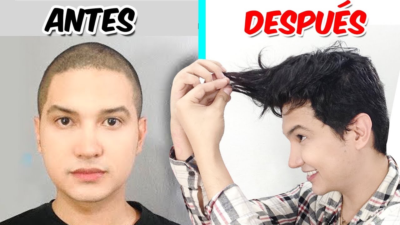 COMO HACER CRECER EL CABELLO NATURALMENTE en una NOCHE con CEBOLLA ...