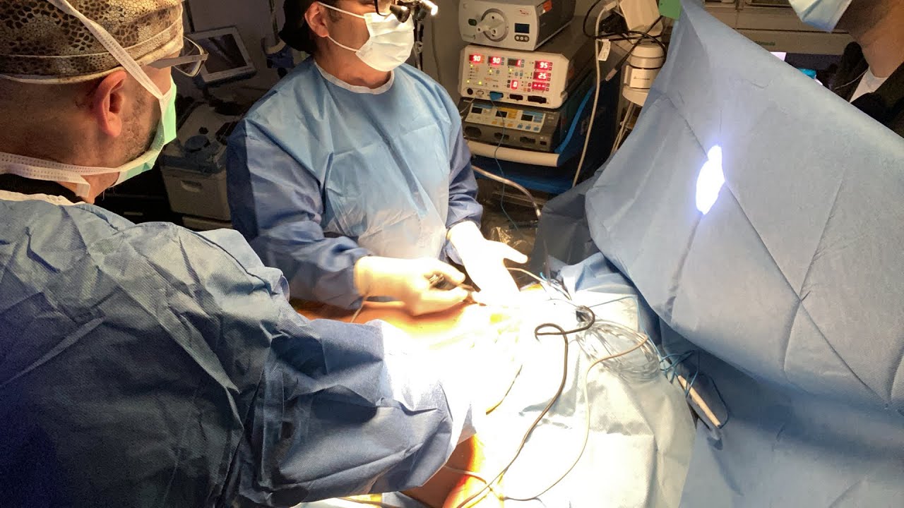 Brachioplasty surgery near me | Dr. Boom boom pow - YouTube