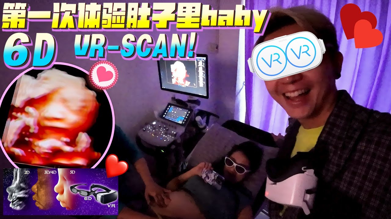 第一次體驗肚子裡baby 6D VR scan！在肚子裡寶寶就有表情了！又笑又哭扁嘴 神奇！ - YouTube