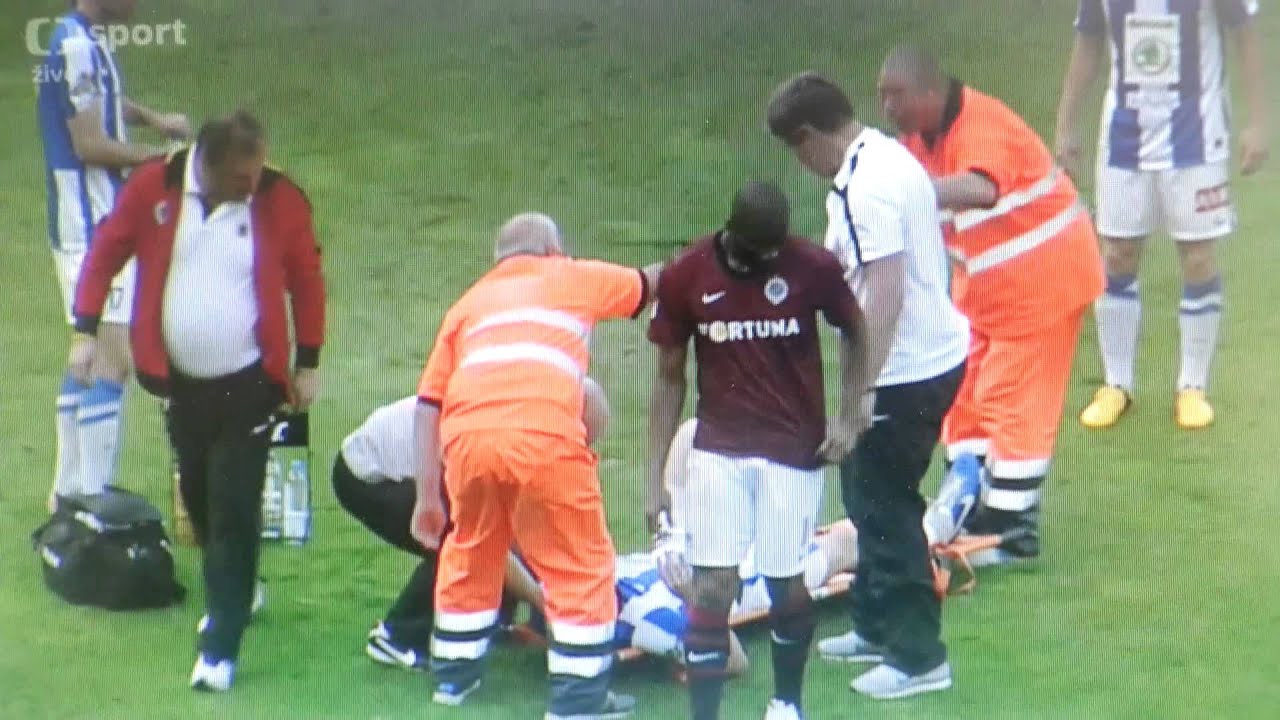 Open fracture of the leg foul football zlomena noha zlomenina Dosoudil ...