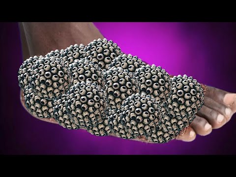 ASMR ANIMATION TREATMENT AND TRYPOPHOBIA DEEP CLEANING FROM LEG ...