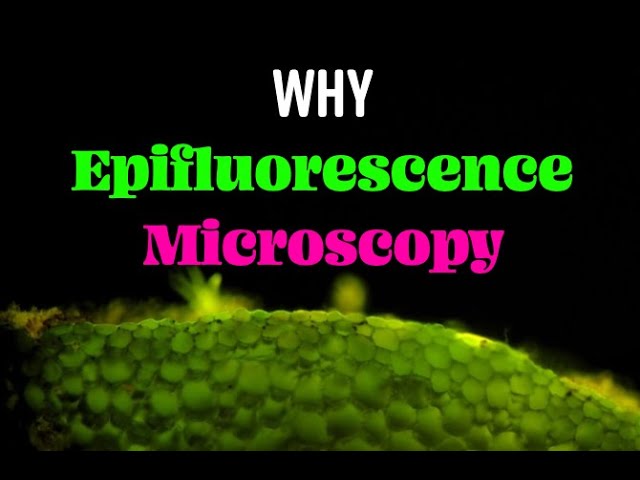 Epifluorescence Microscopy