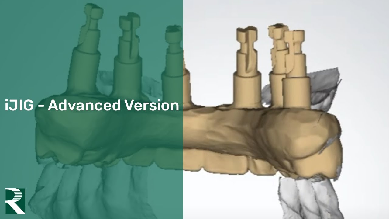 iJIG Plus New Advanced Version - YouTube