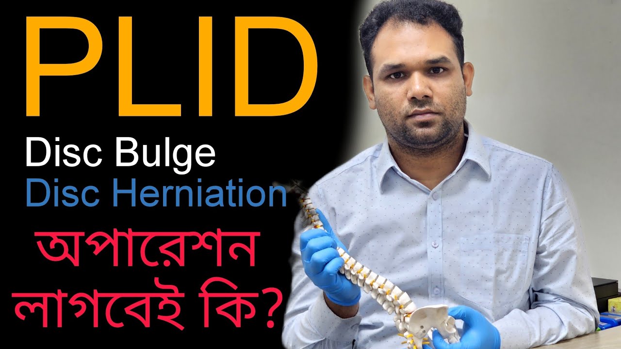 PLID/ Disc Bulge/ Disc Herniation- অপারেশন লাগবে কি? Dr Habib ...
