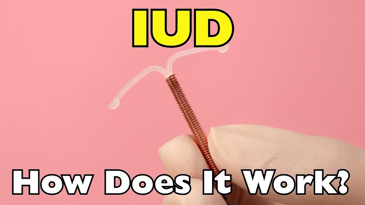 How Does an IUD Work? - YouTube
