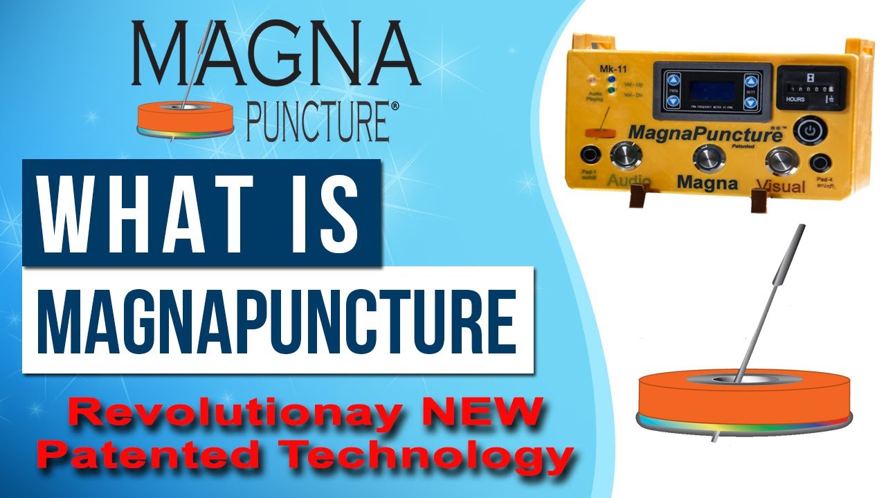 MagnaPuncture: THE FUTURE OF ACUPUNCTURE IS HERE - YouTube