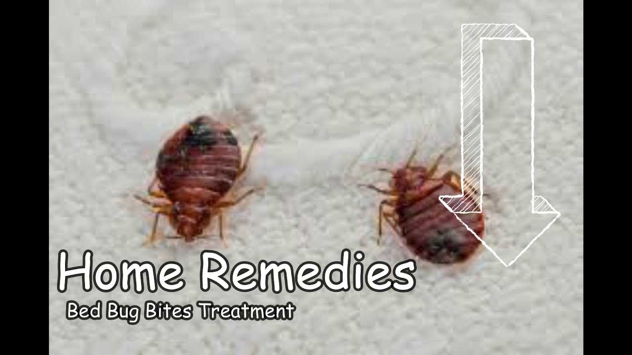 (TAKE NOTE!!!) Home Remedies For Bed Bug Bites Treatment | How To Kill ...